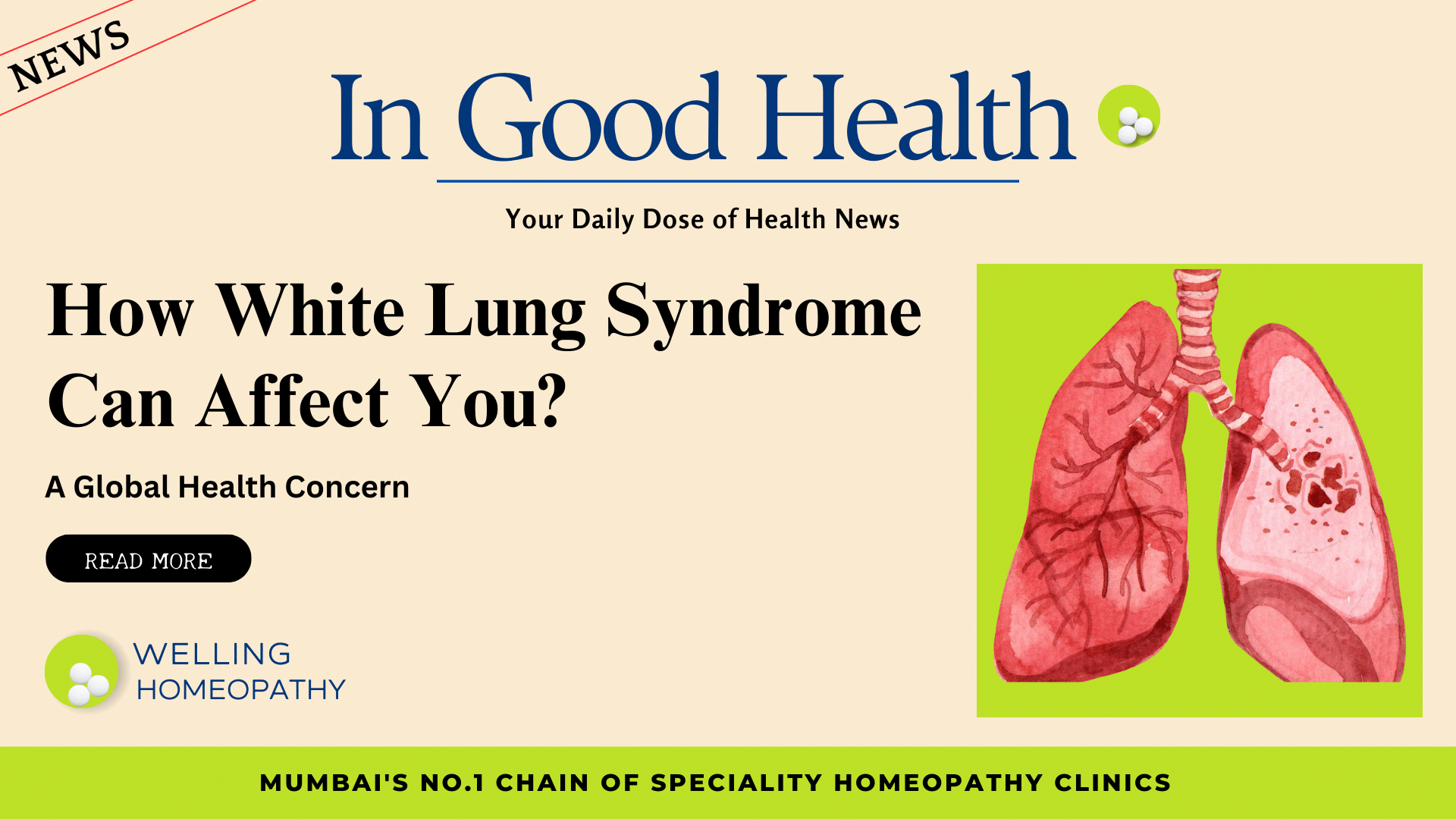 How White Lung Syndrome Can Affect You?